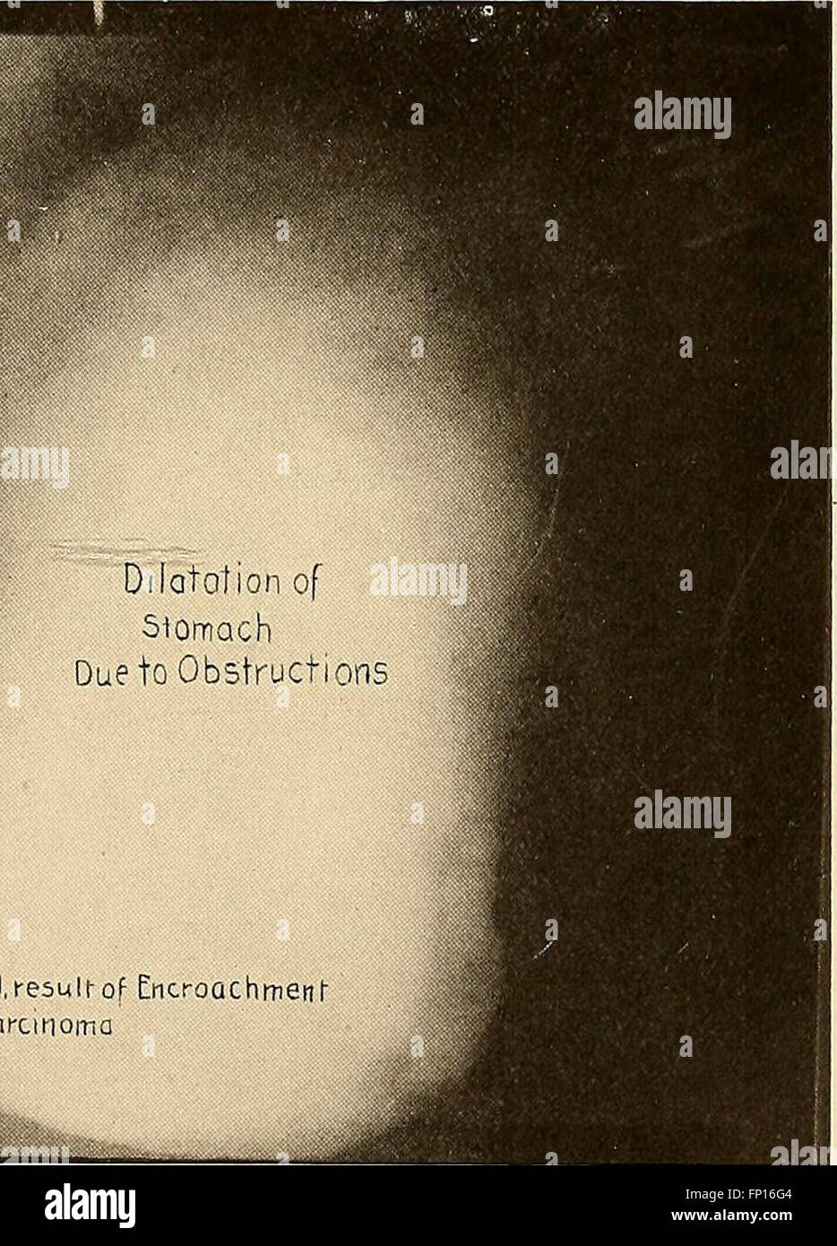 This 1917 manual offers technical guidance on the use of X-ray ...