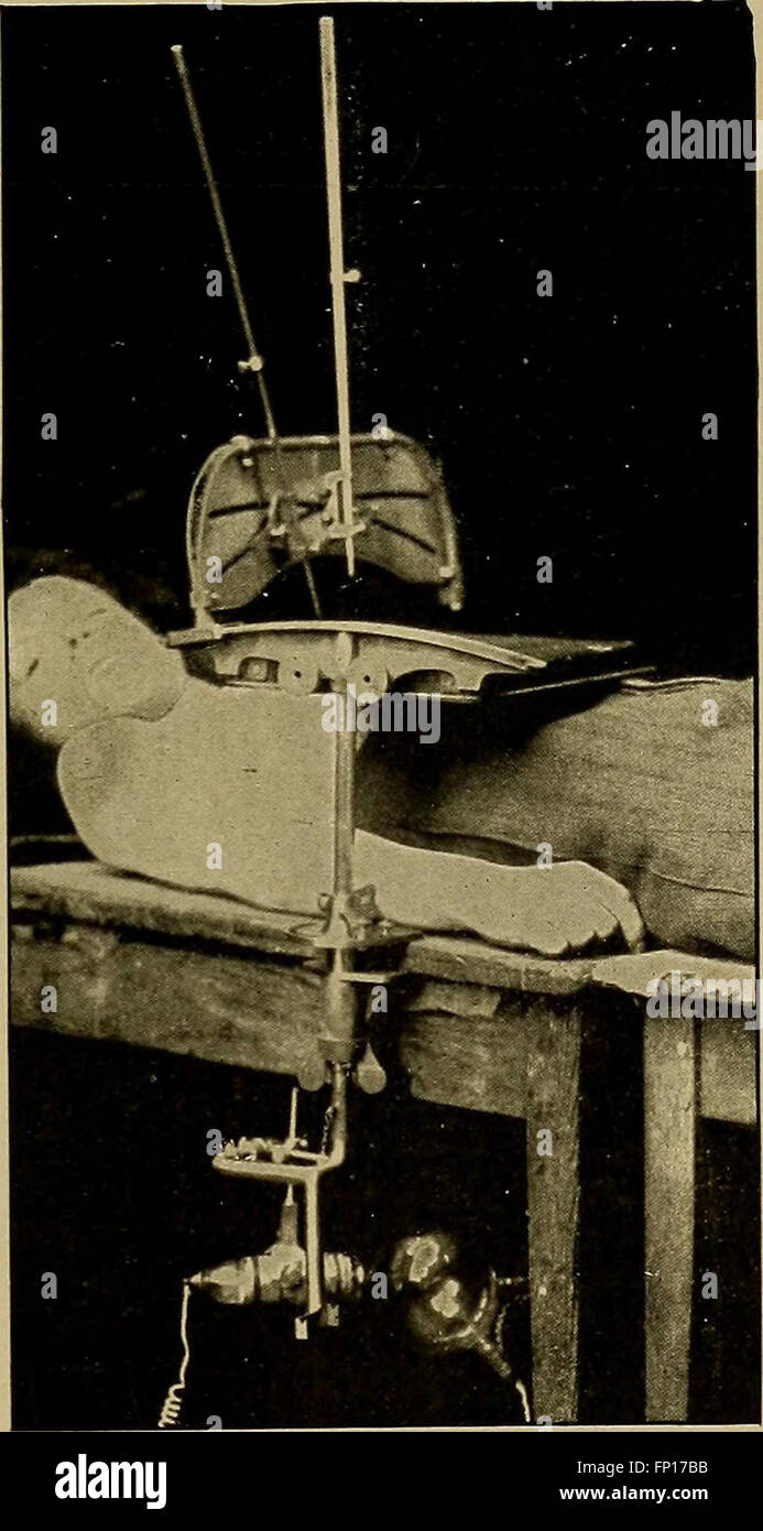 This system of instruction offers a pictorial guide to X-ray methods ...