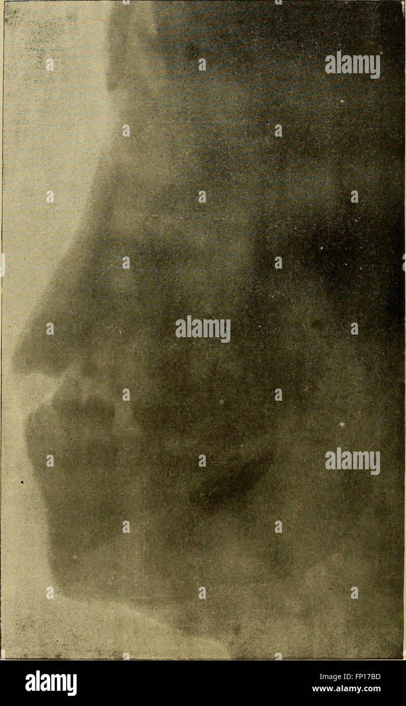 This guide provides instructional material on X-ray methods, light ...