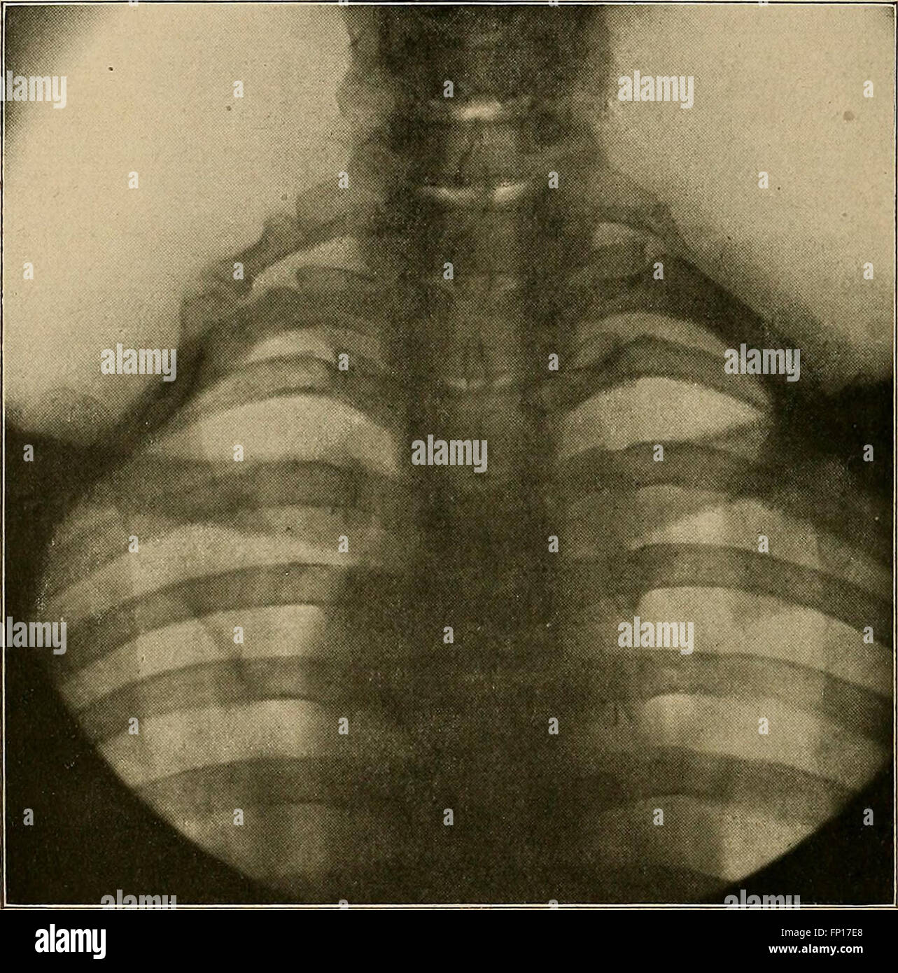 This 1915 text-book on radiology provides an introduction to the use of ...