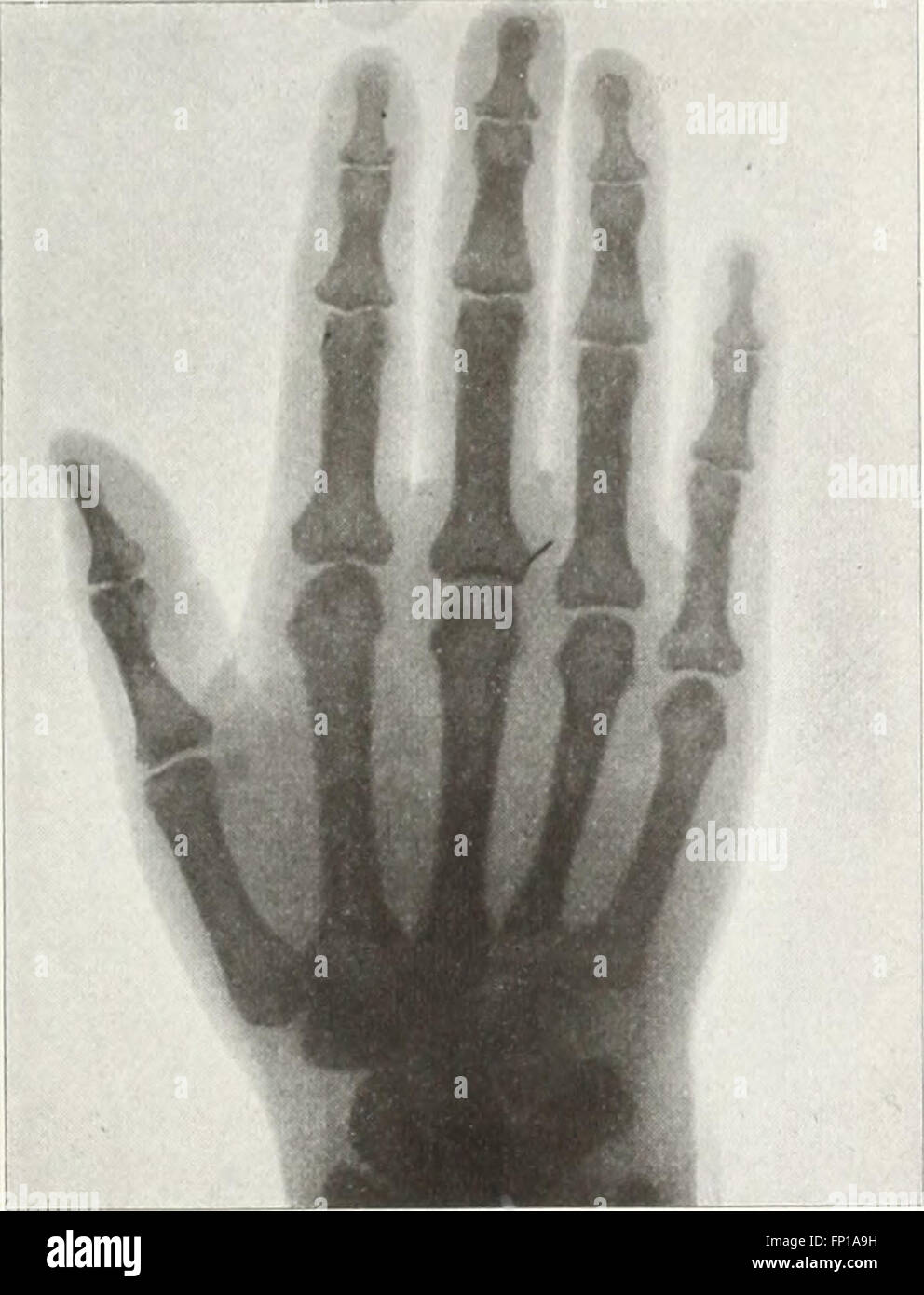 The 1897 edition of the American X-ray Journal explores early ...