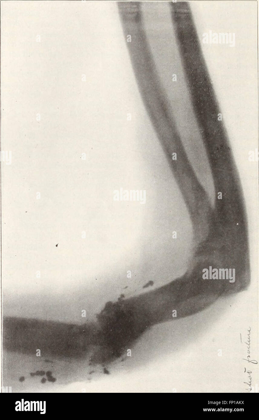 The *American X-ray Journal* of 1897 explores early developments in X ...