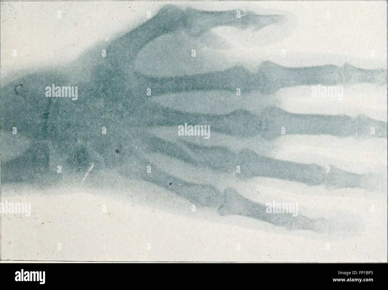 The American X-ray Journal (1897) focuses on the early advancements in ...