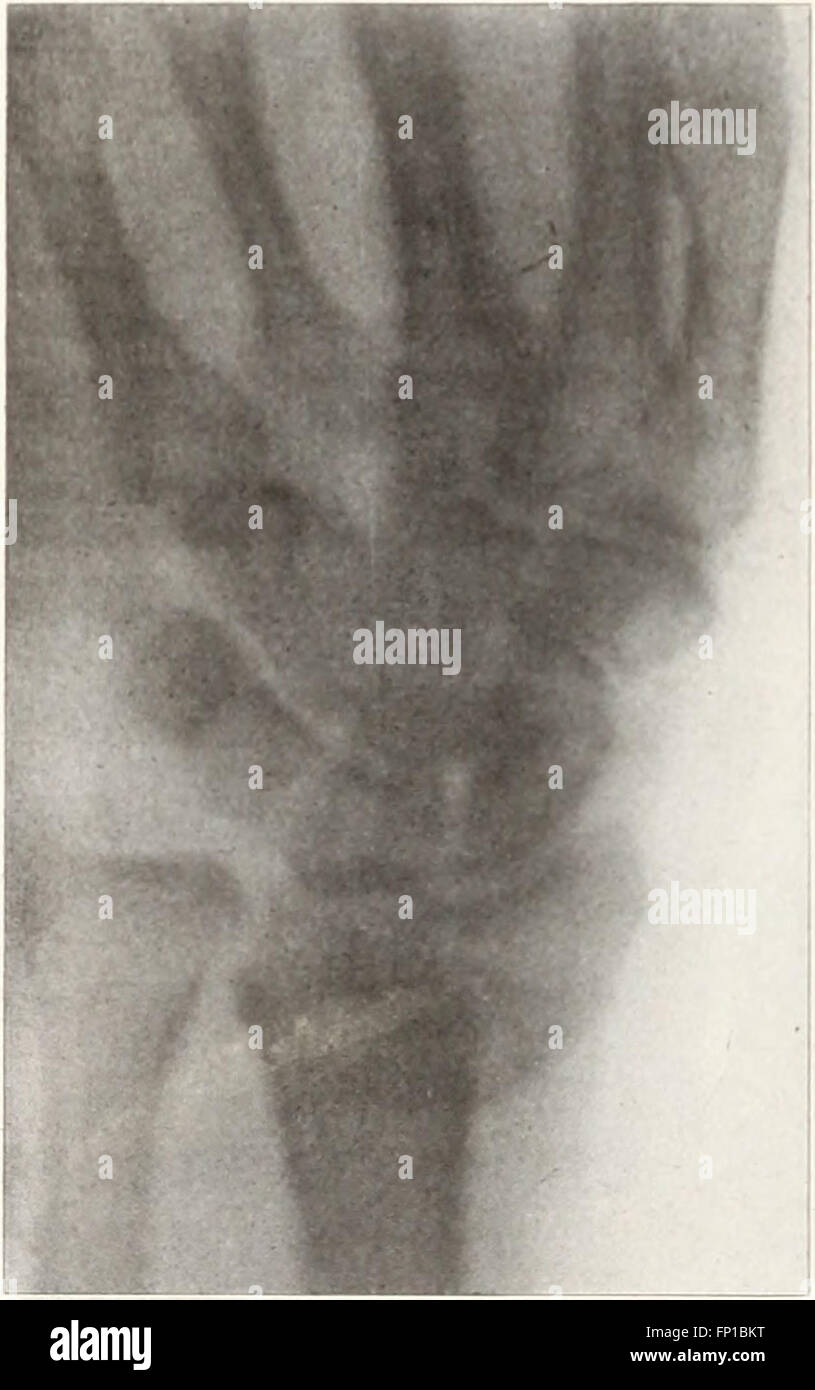 American X-ray journal (1897 Stock Photo - Alamy