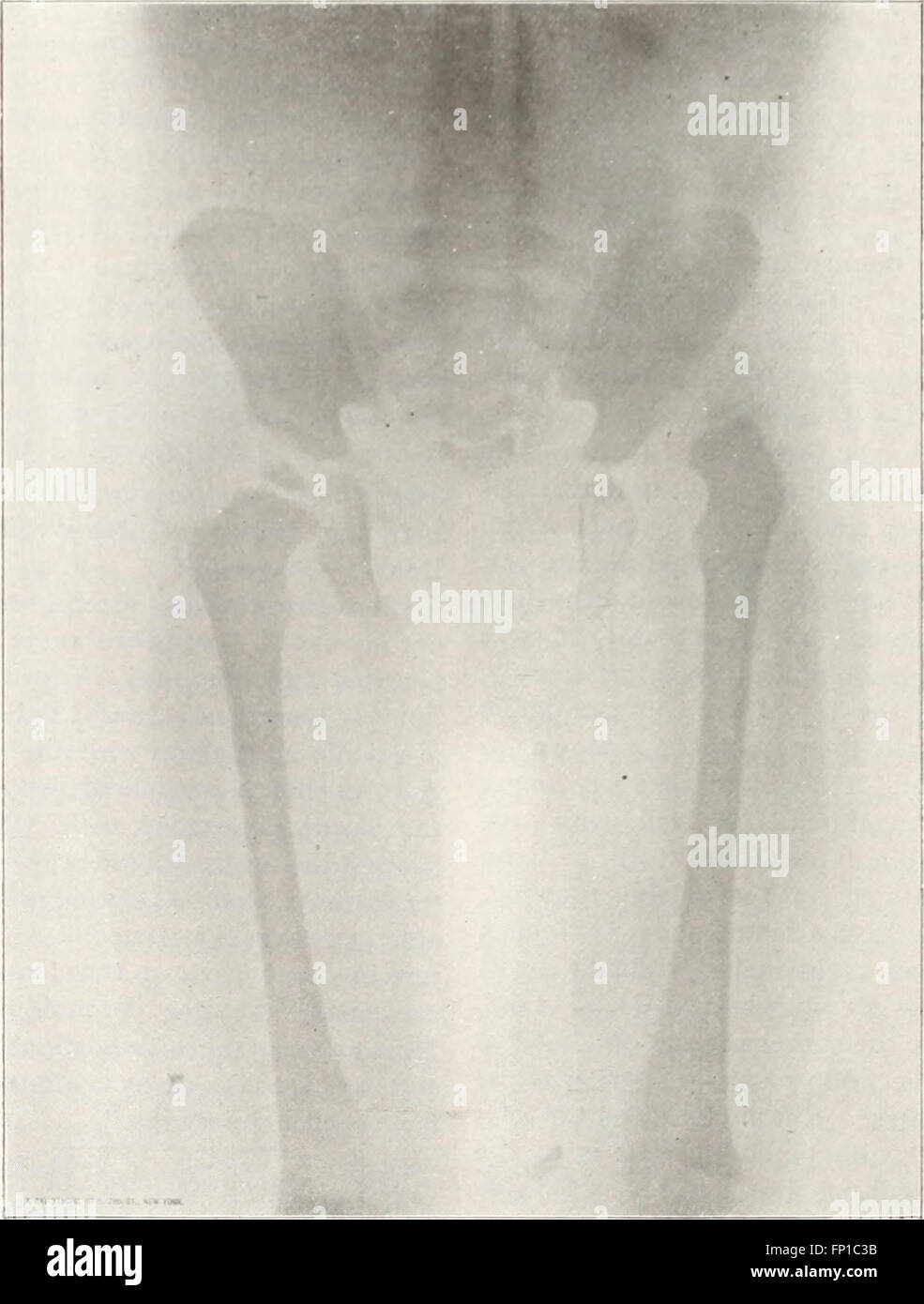 American X-ray journal (1897 Stock Photo - Alamy