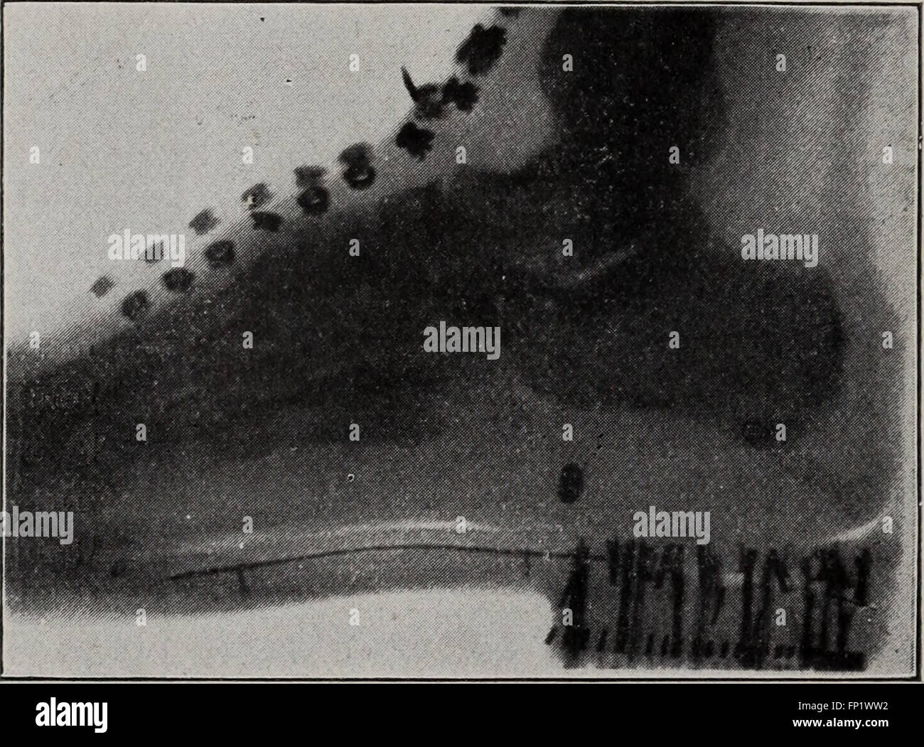 The 'American X-ray Journal' (1899) focuses on the advancements in X ...