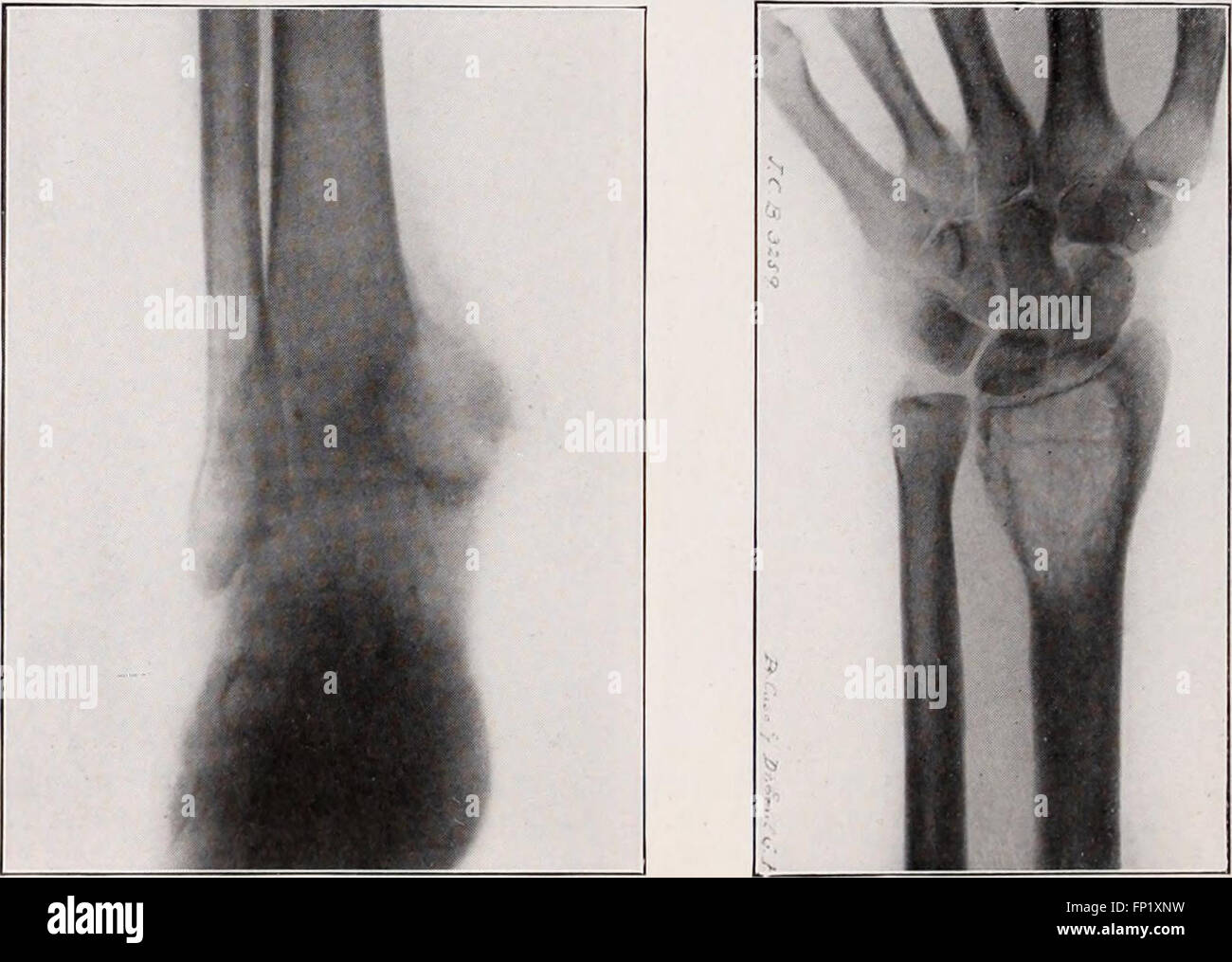 The 1920 Journal of Radiology features advances in medical imaging ...