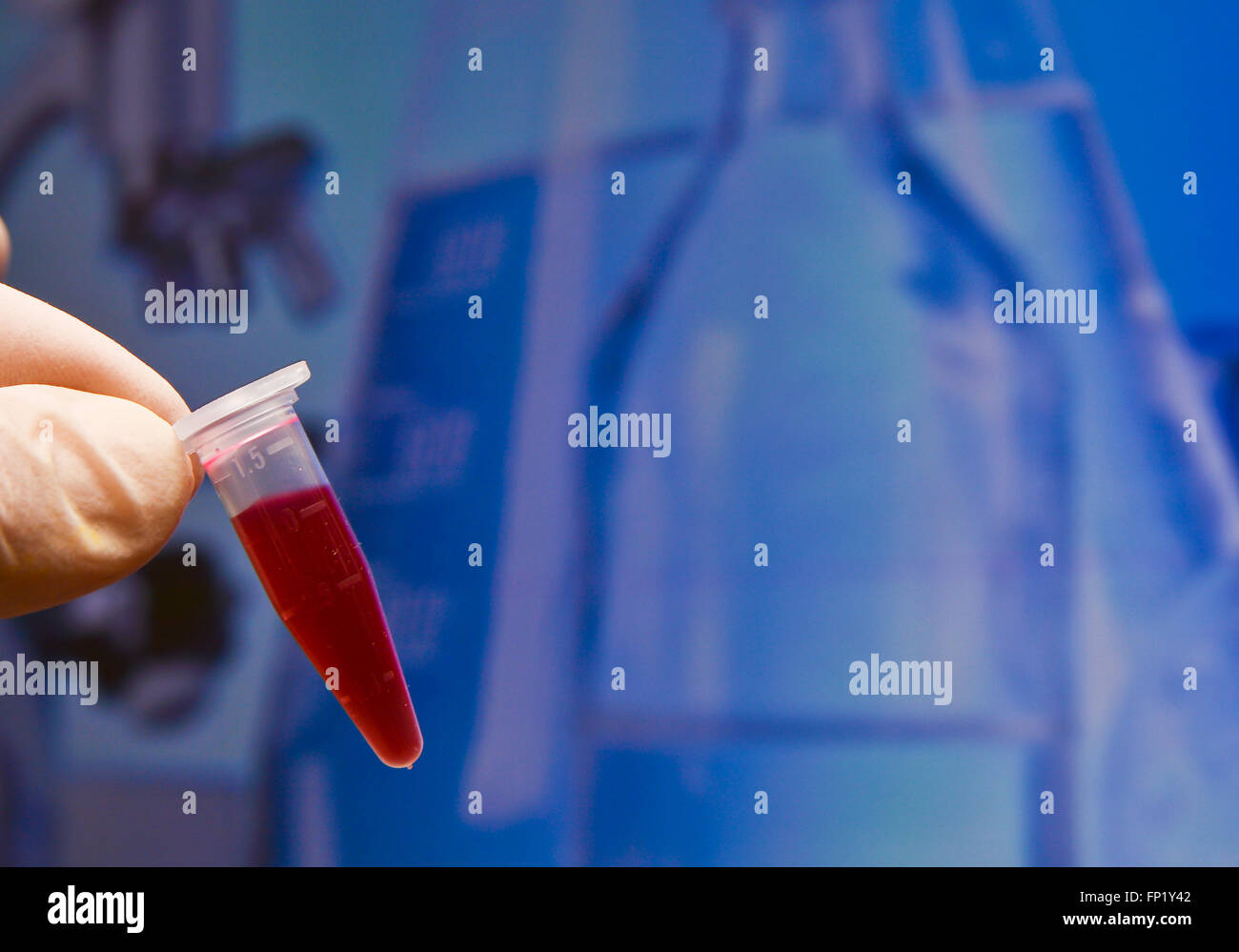 The tube of blood. The study of human blood in medical labs Stock Photo ...