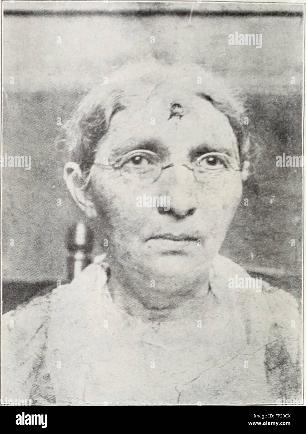 American X-ray journal (1904 Stock Photo - Alamy