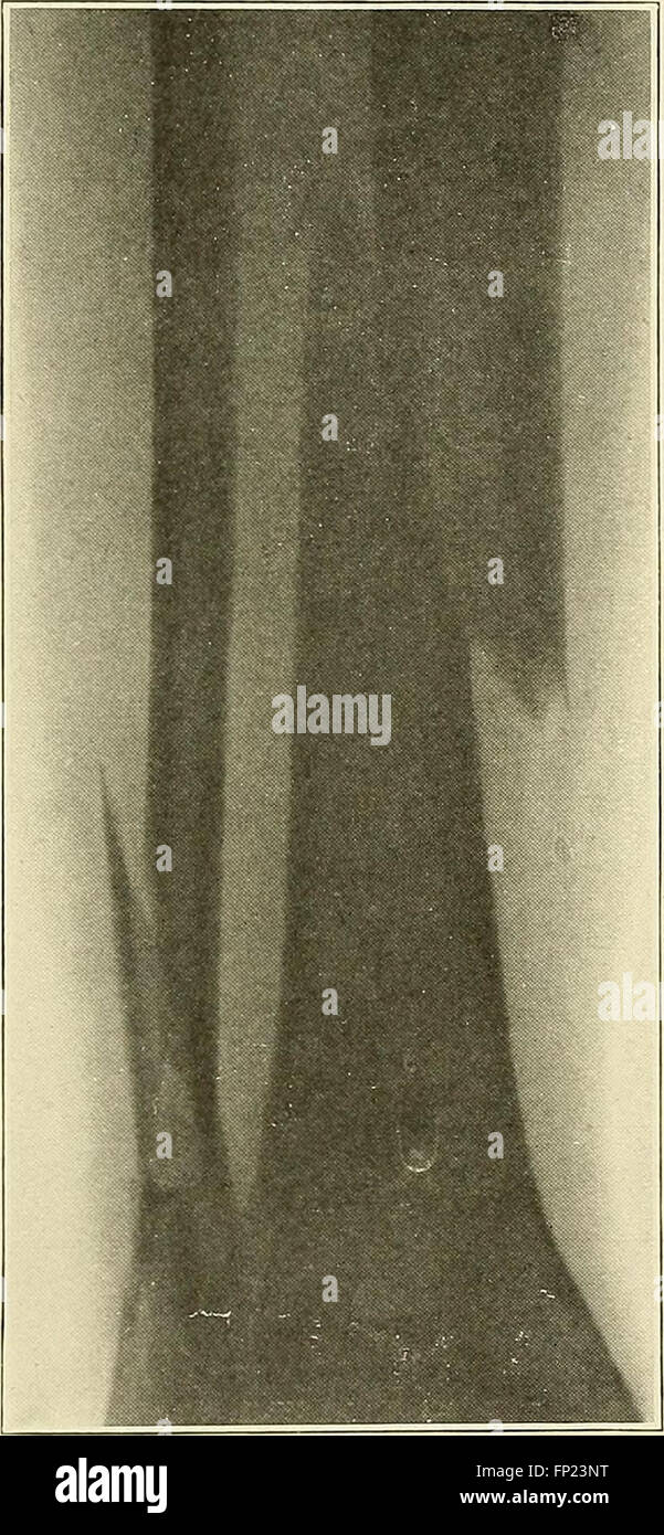 Practical exposure hi-res stock photography and images - Alamy