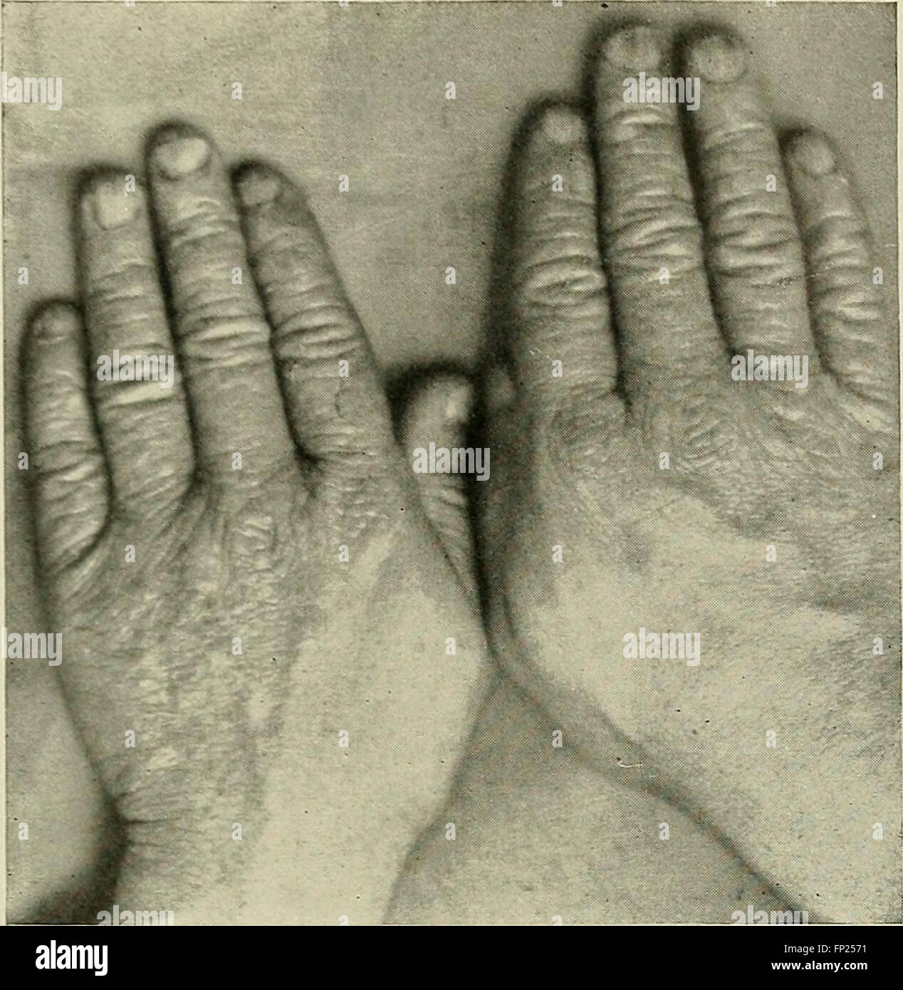 *Röntgen Rays and Electro-Therapeutics* (1910) explores the therapeutic ...