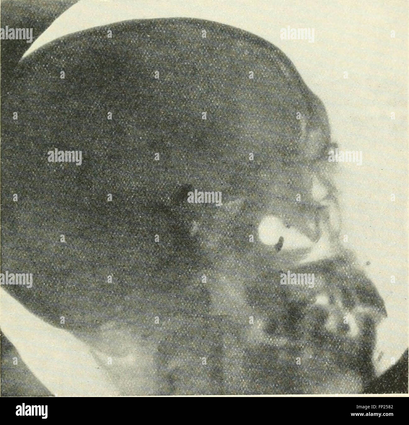 This 1915 text discusses the use of radiography, X-ray therapy, and ...