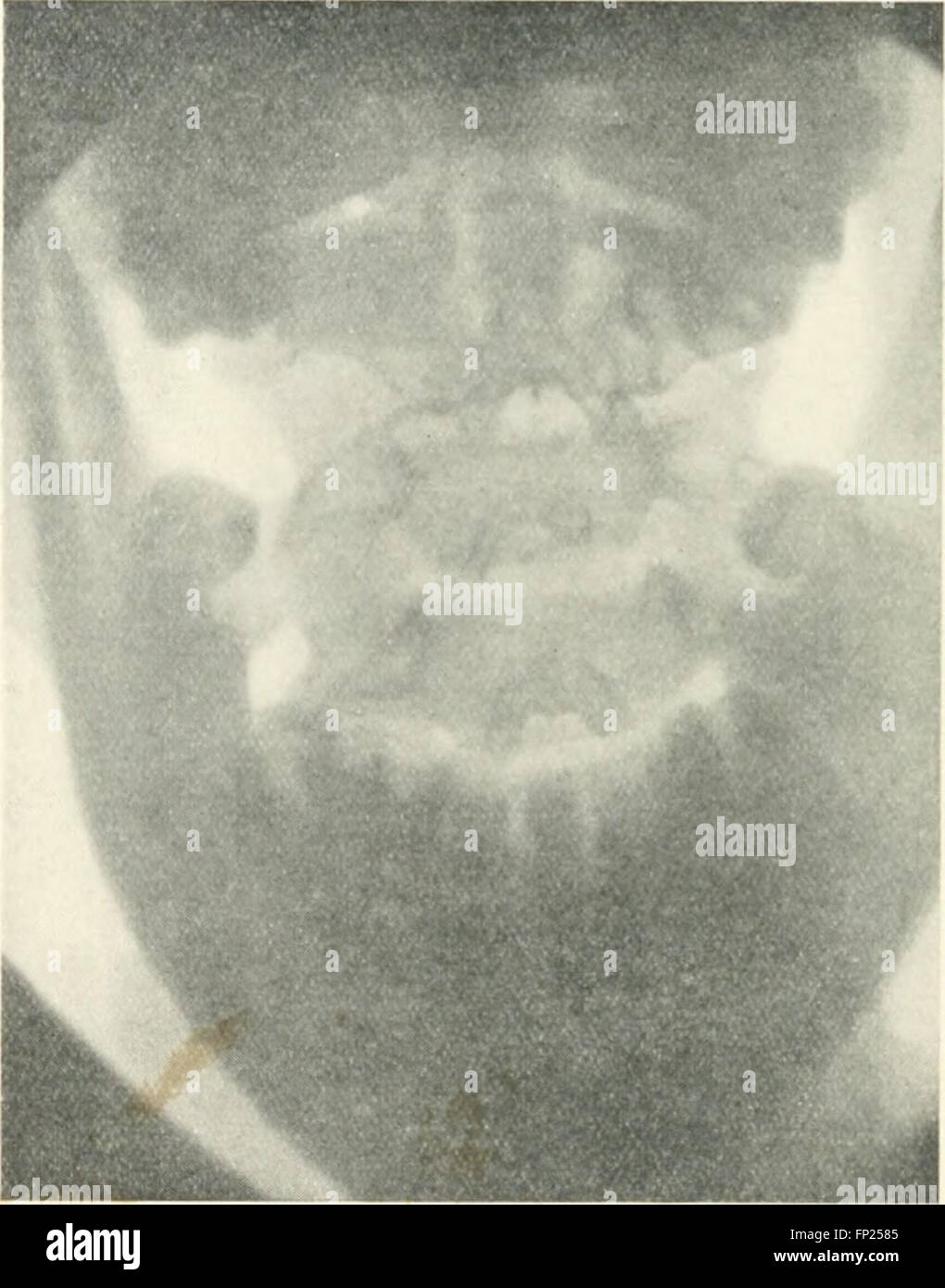 This 1915 work explores radiography, X-ray therapeutics, and the ...