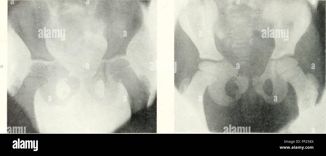 'Radiography, X-ray Therapeutics and Radium Therapy' (1915) covers the ...