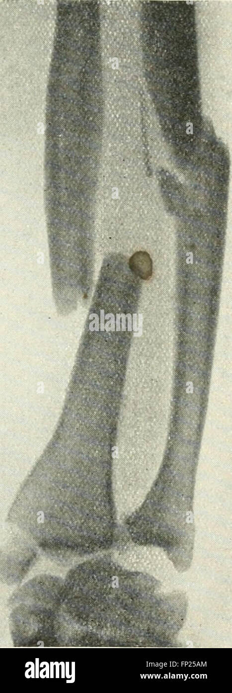 Radiography, x-ray therapeutics and radium therapy (1915 Stock Photo ...