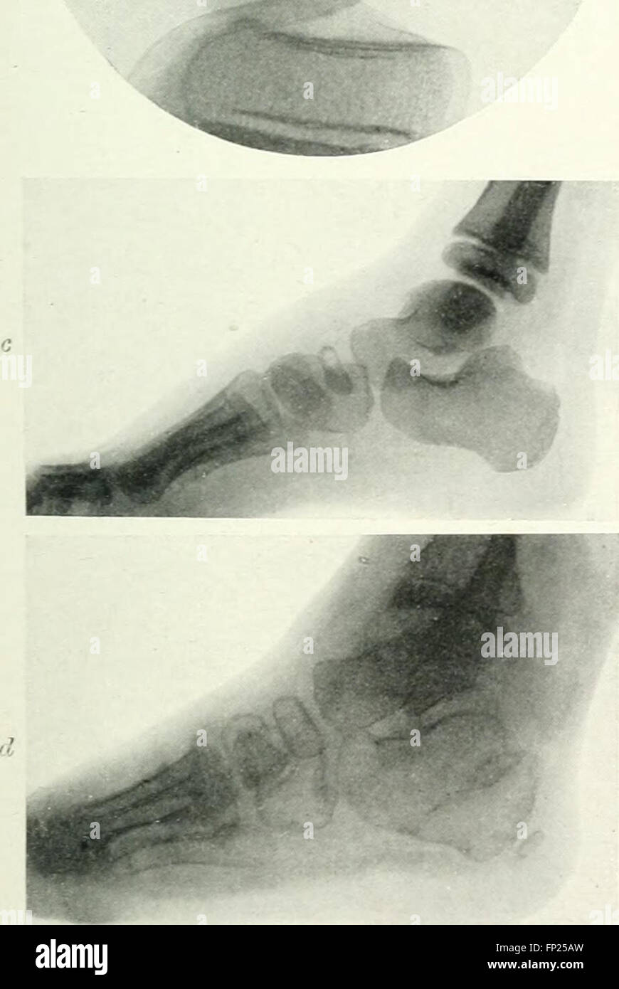 'Radiography, X-ray Therapeutics, and Radium Therapy' (1915) explores ...