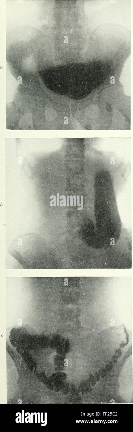 Radiography, x-ray therapeutics and radium therapy (1915 Stock Photo ...