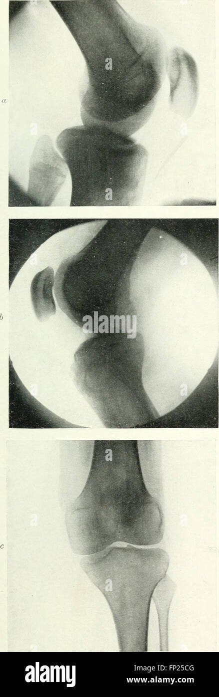 This work discusses the applications of radiography, x-ray therapeutics ...