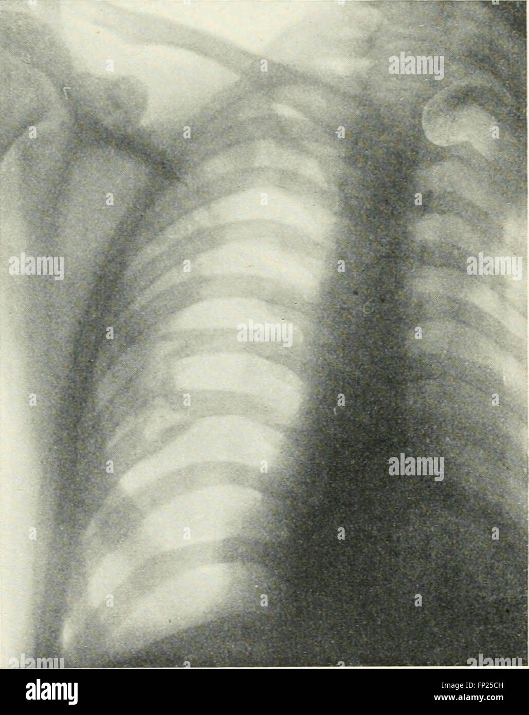 This 1915 work explores the use of radiography, X-ray therapeutics, and ...