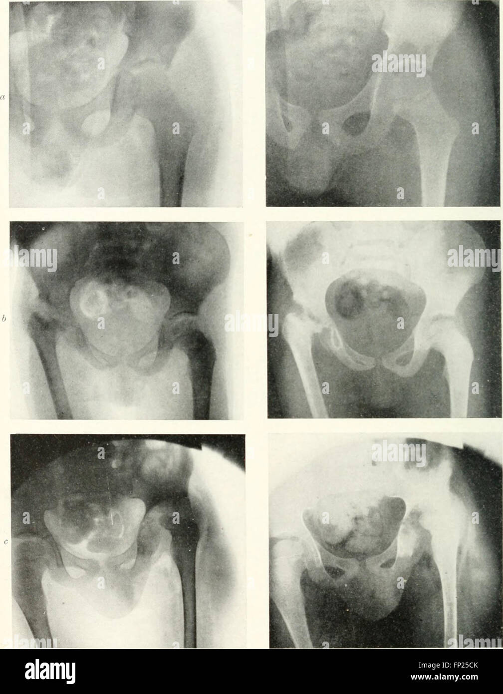 This 1915 work discusses radiography, X-ray therapeutics, and radium ...