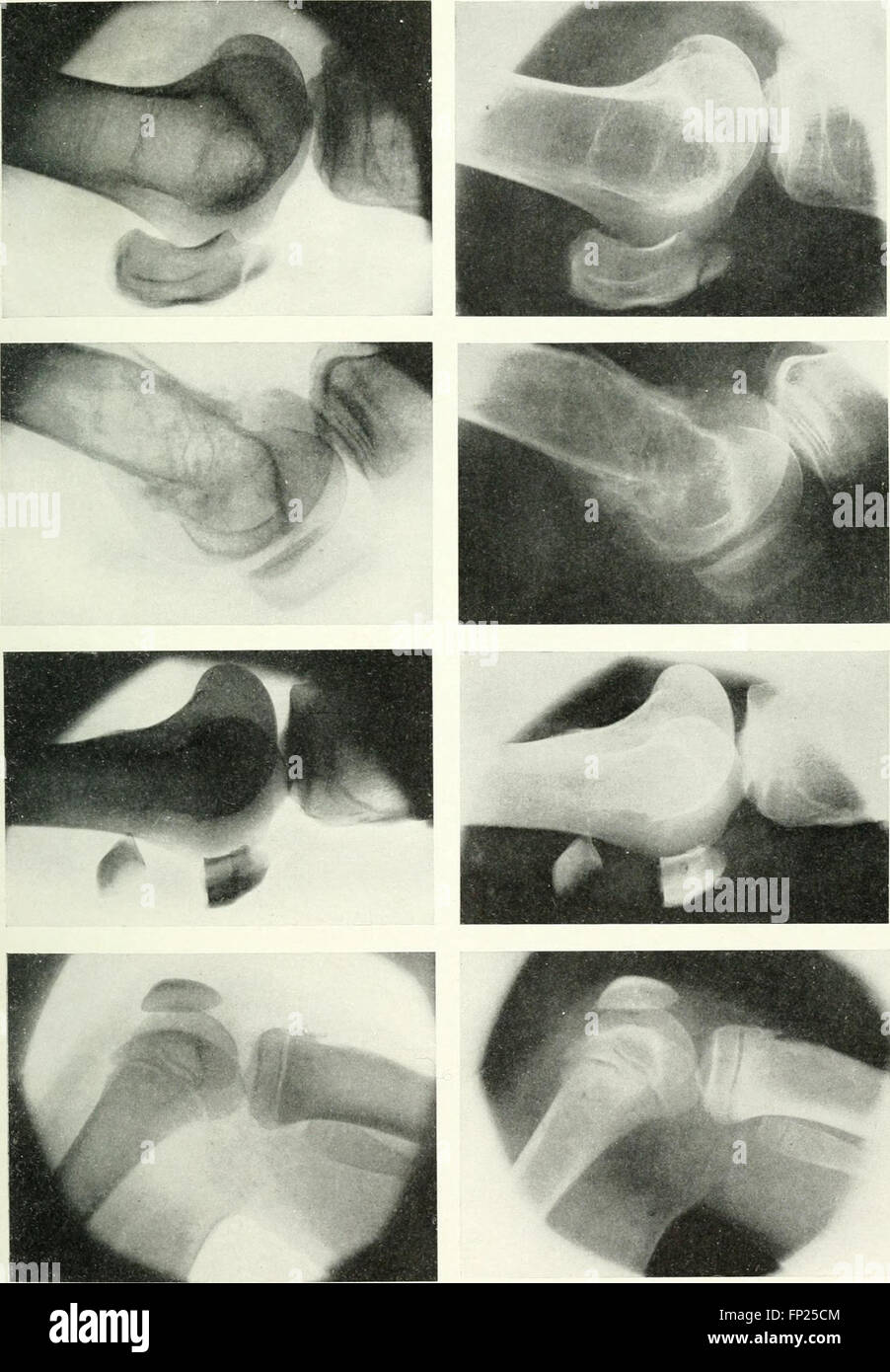 The 1915 publication covers the use of radiography, X-ray therapeutics ...