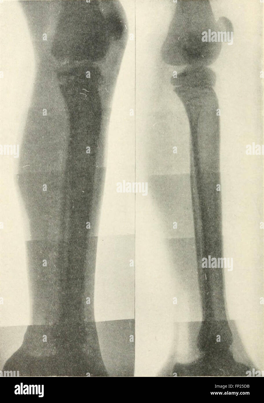 This 1915 publication explores the fields of radiography, X-ray ...