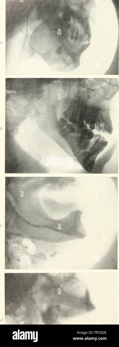 Radiography, x-ray therapeutics and radium therapy (1915 Stock Photo ...