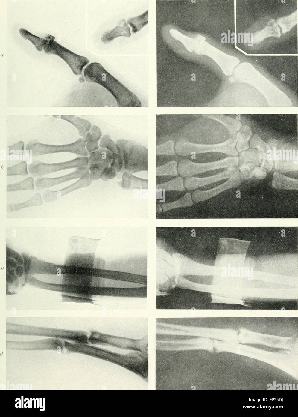 Radiography, x-ray therapeutics and radium therapy (1915 Stock Photo ...