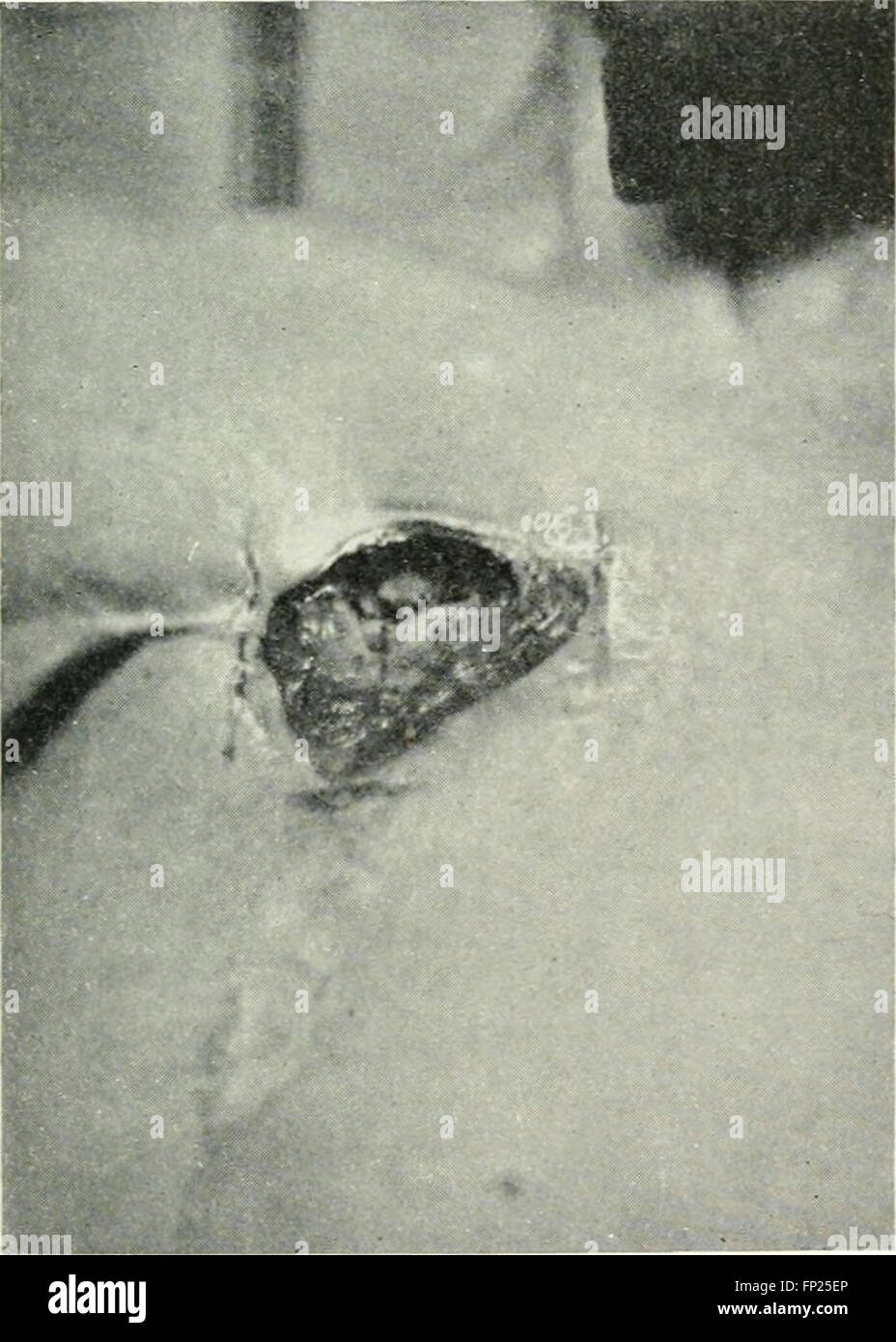 This 1915 work focuses on the medical applications of radiography, X ...