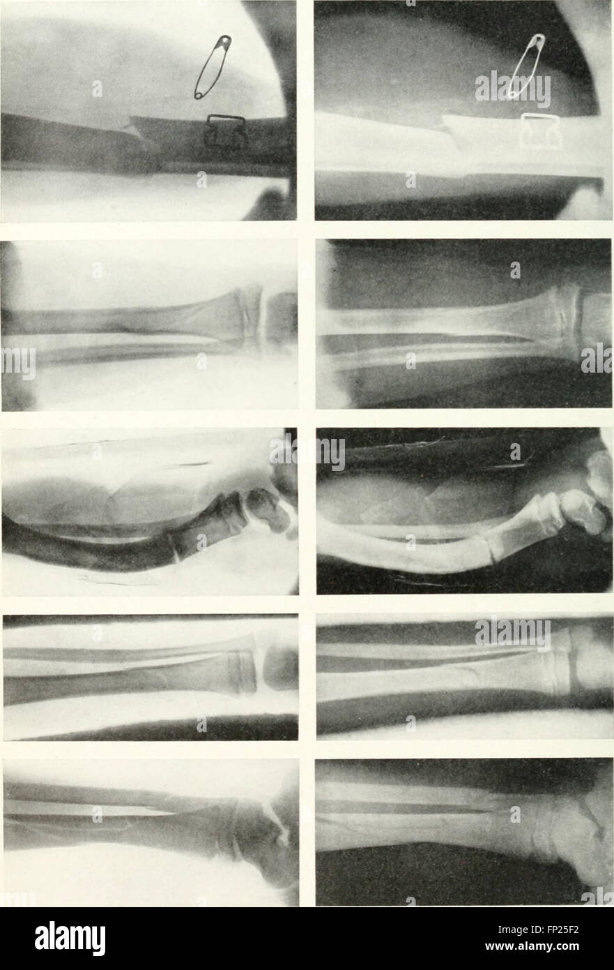 A comprehensive study on the medical uses of radiography, X-ray ...