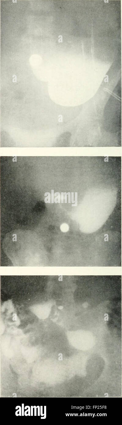 This work discusses the applications of radiography, x-ray therapeutics ...