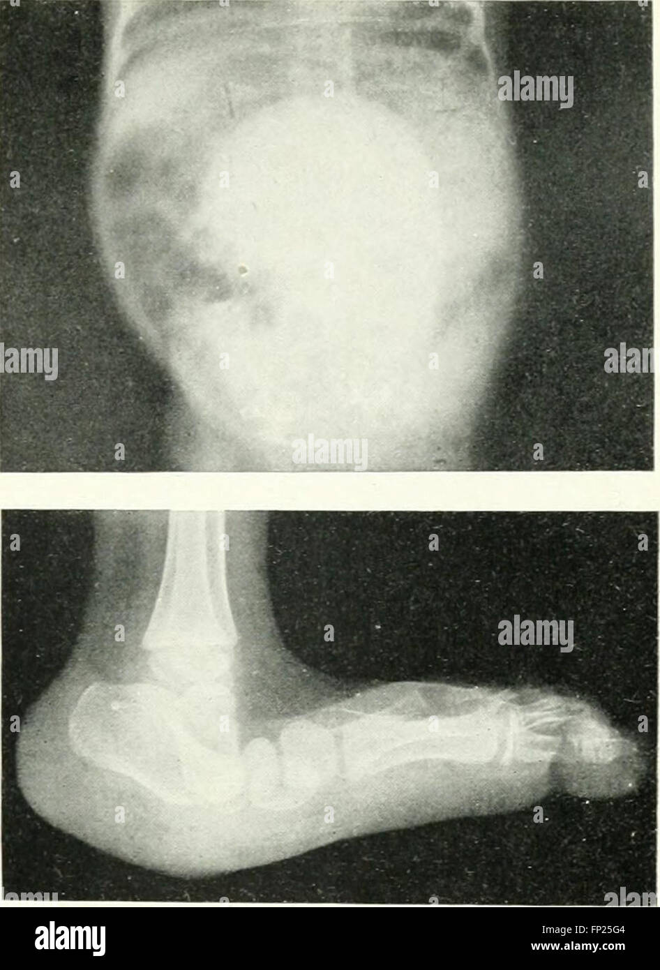 'Radiography, X-ray Therapeutics, and Radium Therapy' (1915) explores ...