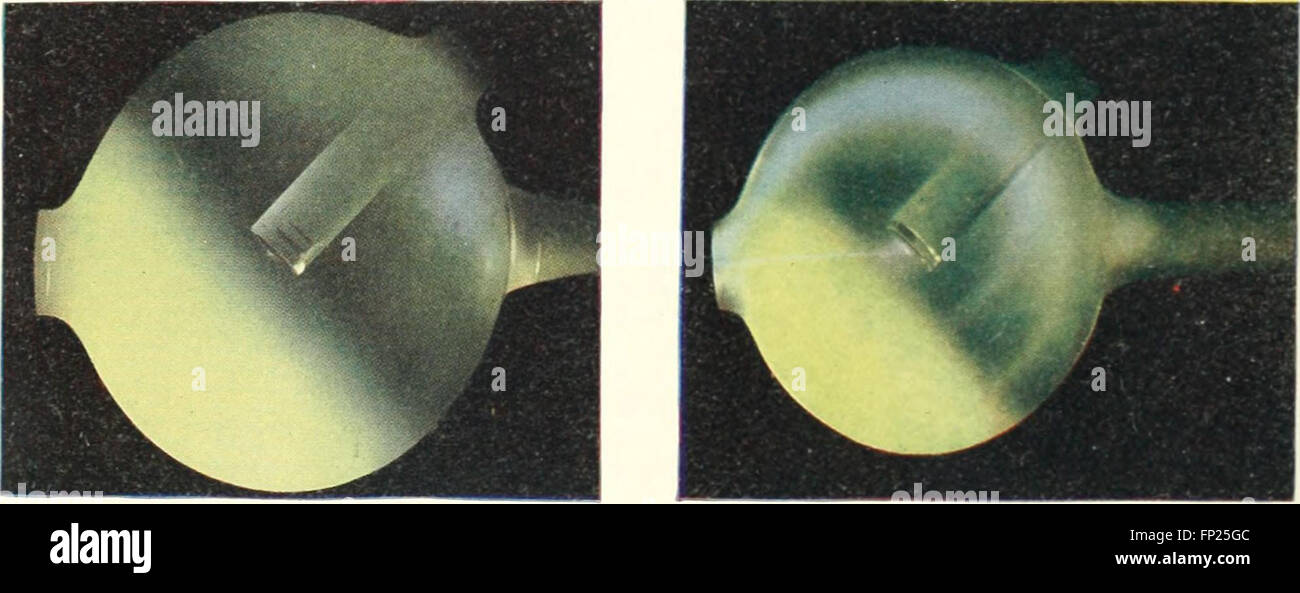 A 1915 work focusing on the use of radiography, x-ray therapeutics, and ...