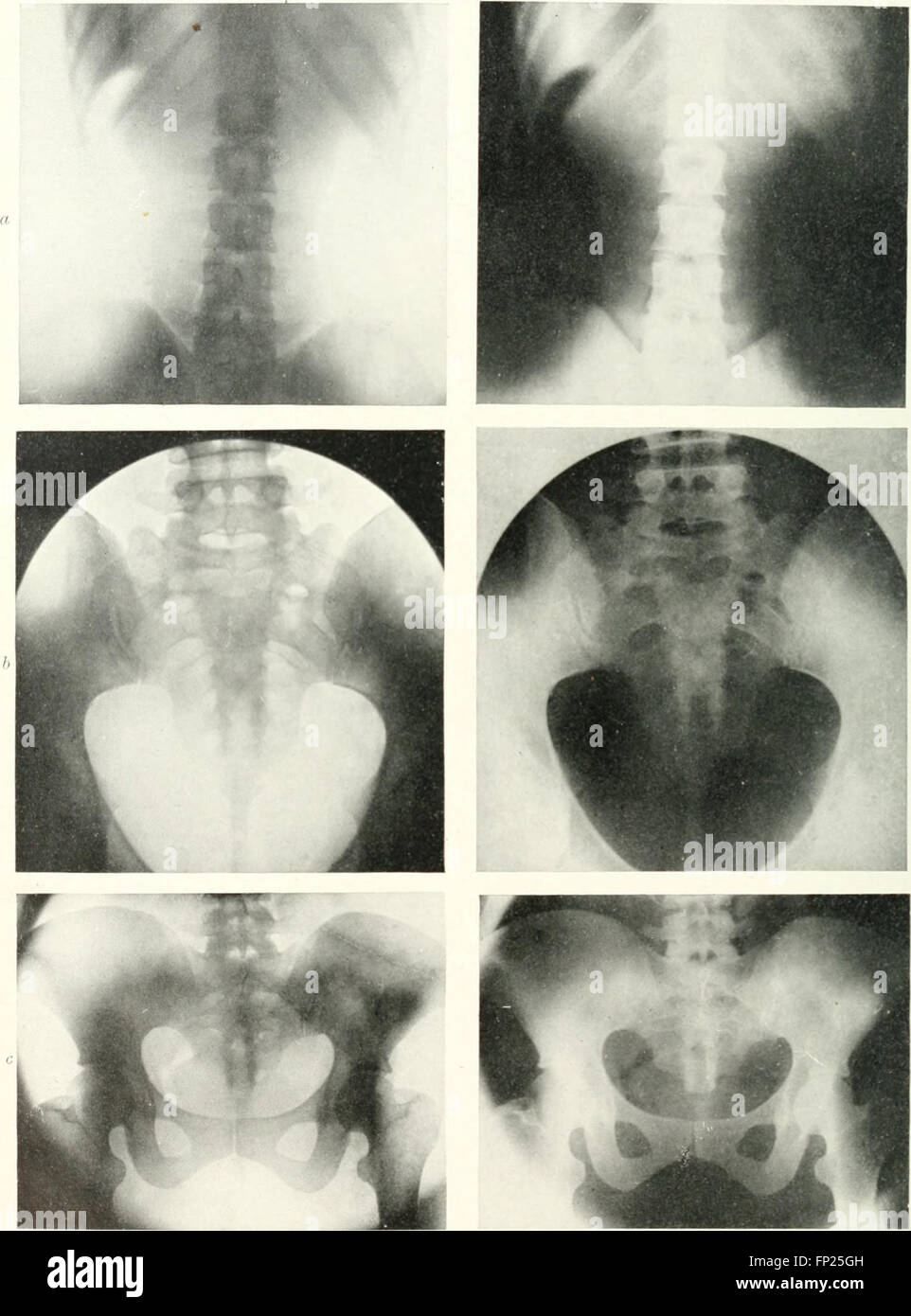 This 1915 publication discusses radiography, X-ray therapeutics, and ...
