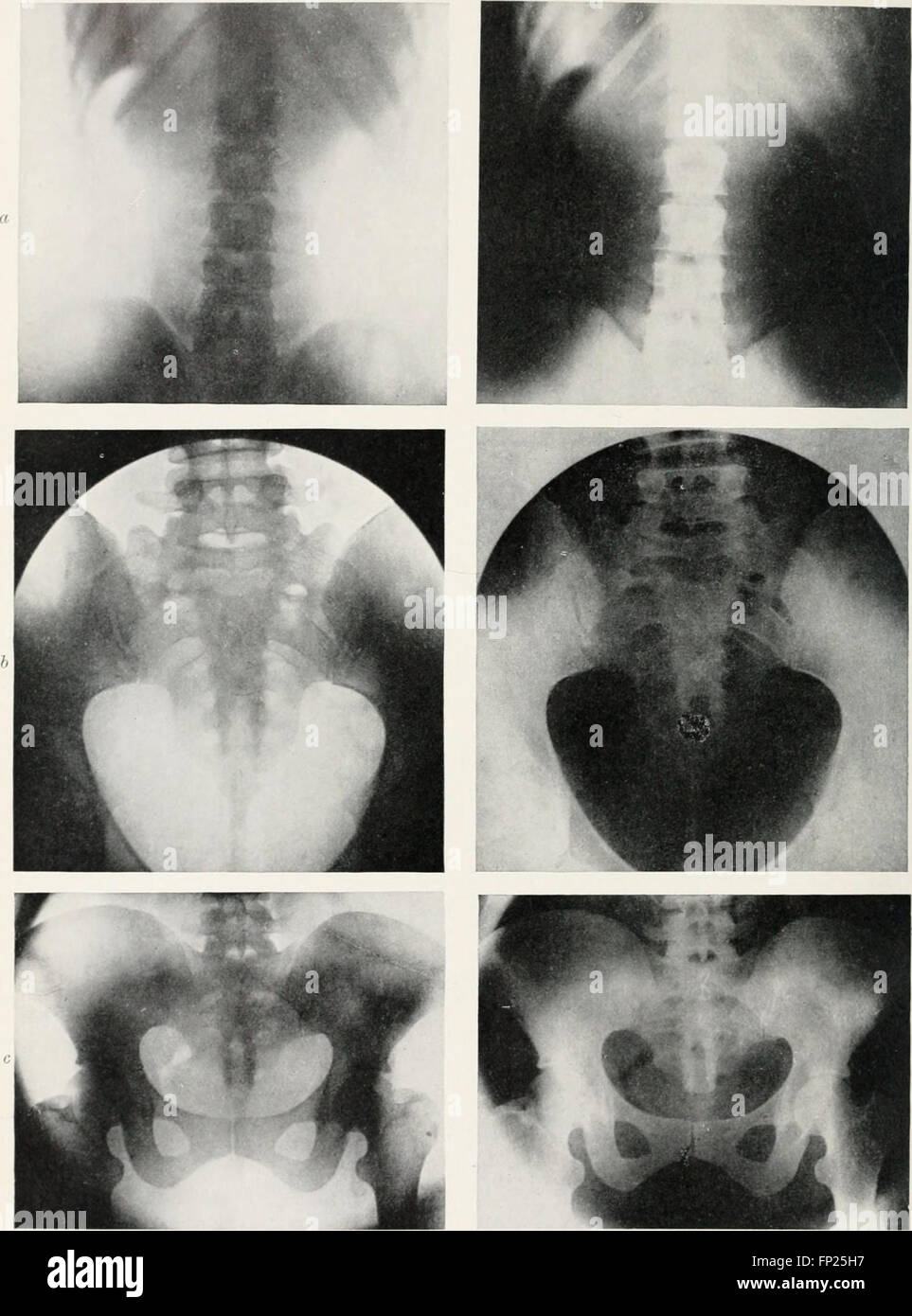 This work explores the medical applications of radiography, including ...