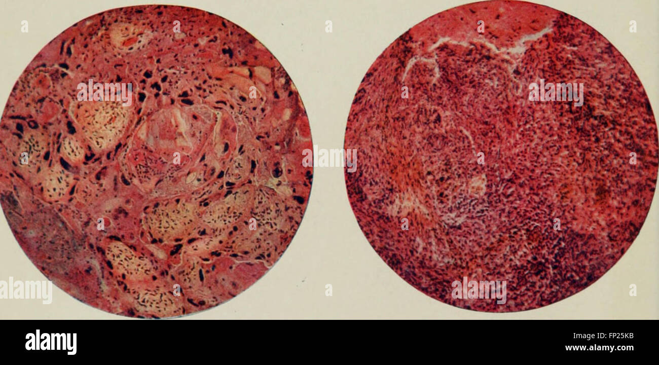 This 1915 publication explores the effects of radium and X-rays on ...
