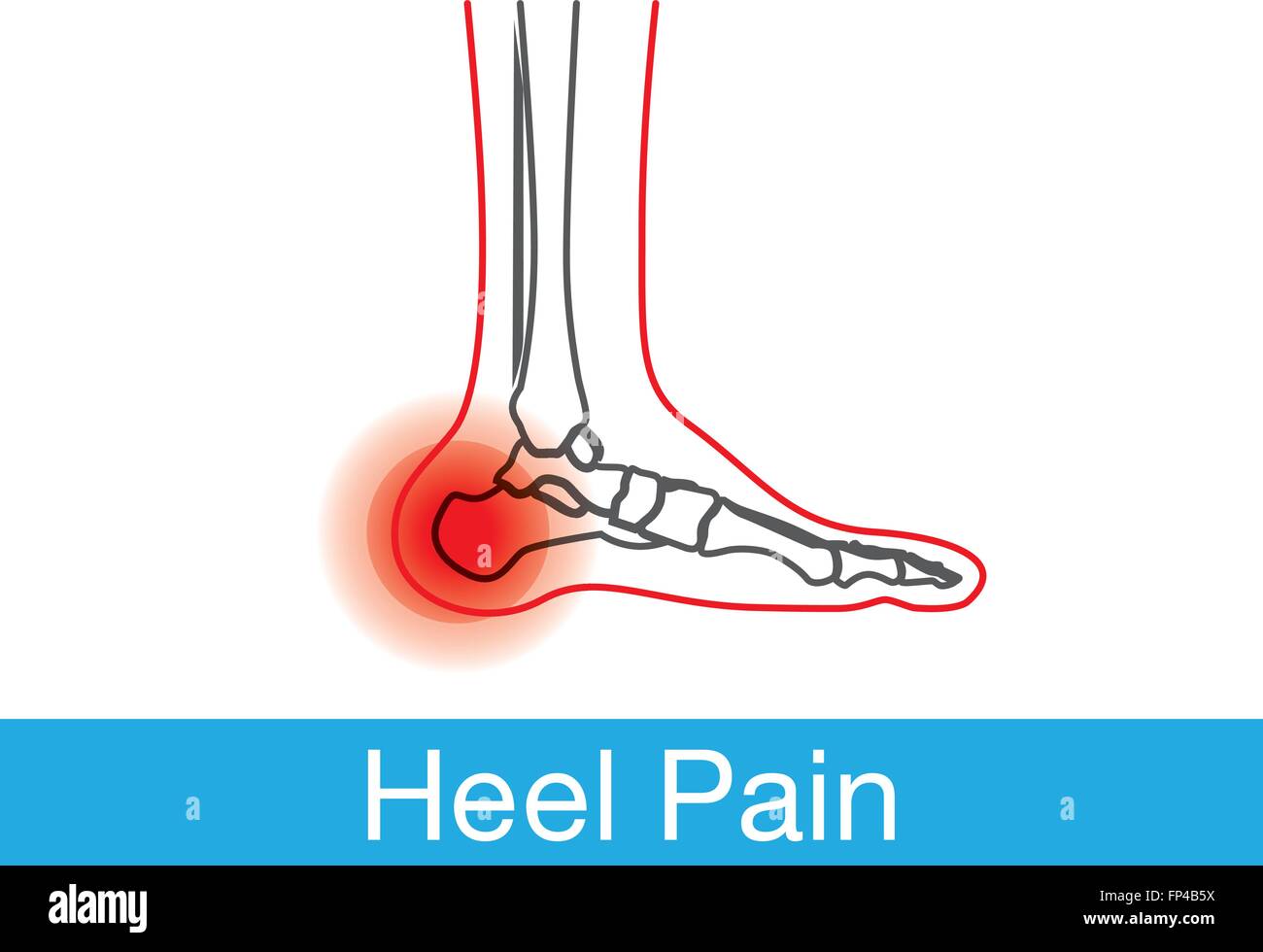 Heel pain outline Stock Vector Image & Art - Alamy