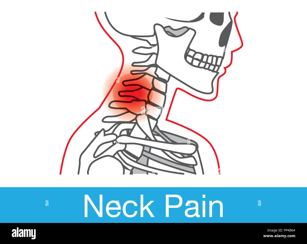 Neck pain outline Stock Vector Image & Art - Alamy