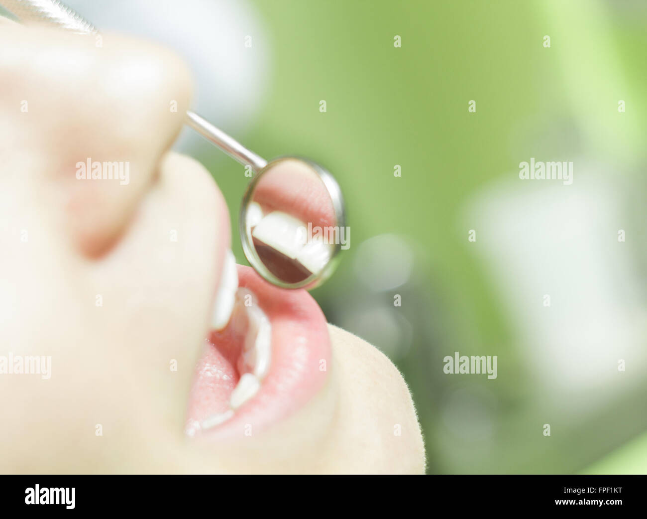 Young woman teeth close up dentist check Stock Photo - Alamy