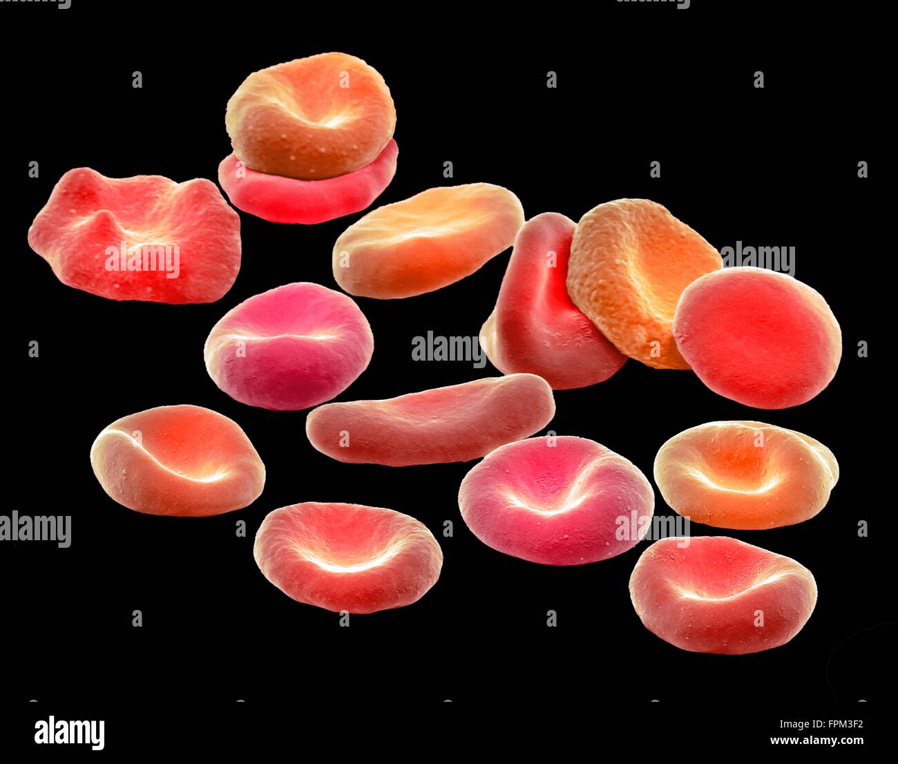Red blood cells. Coloured scanning electr micrograph (SEM) of red blood ...