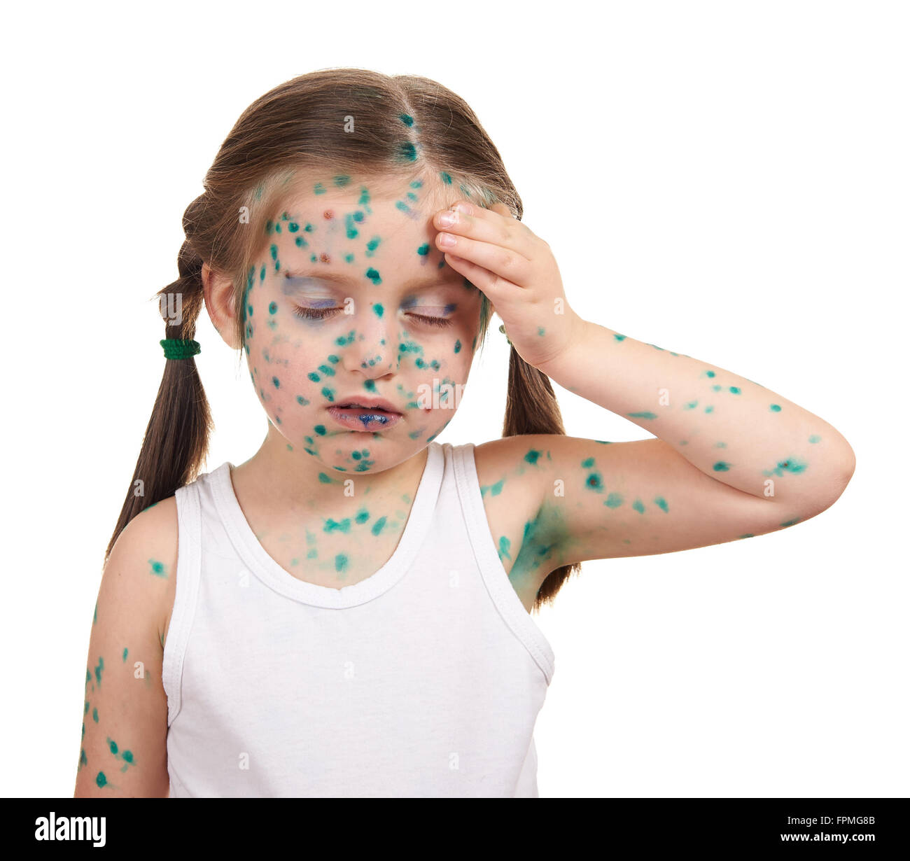 sick child has the virus on skin Stock Photo - Alamy