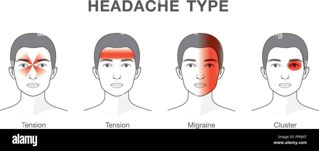 Man doctor stress headache Stock Vector Images - Alamy