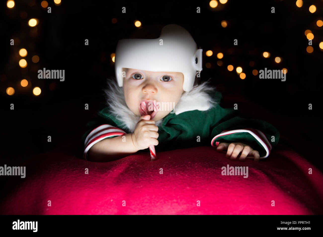 Dolichocephaly baby hi-res stock photography and images - Alamy
