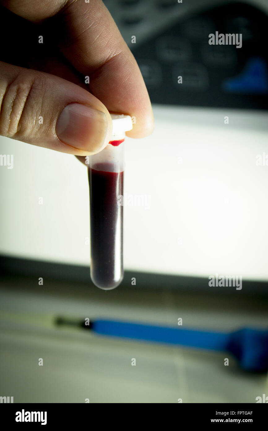 Coagulated blood tube held by woman's hand in laboratory Stock Photo ...