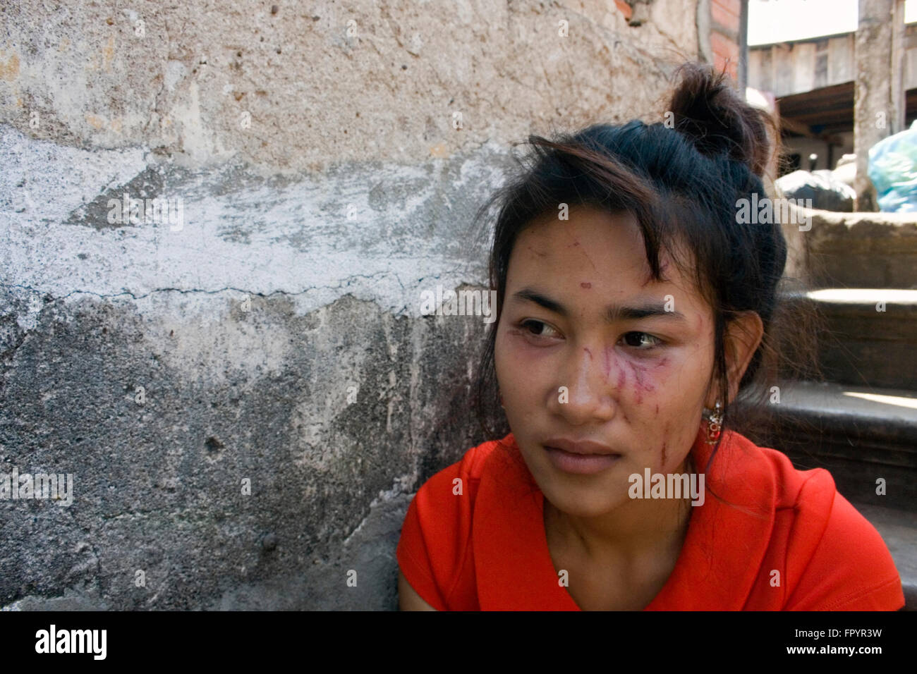 A woman who is a karaoke bar worker displays scars on her face she ...