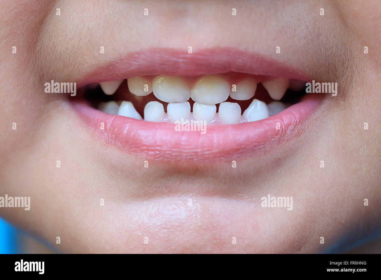 Toothless mouth hi-res stock photography and images - Alamy