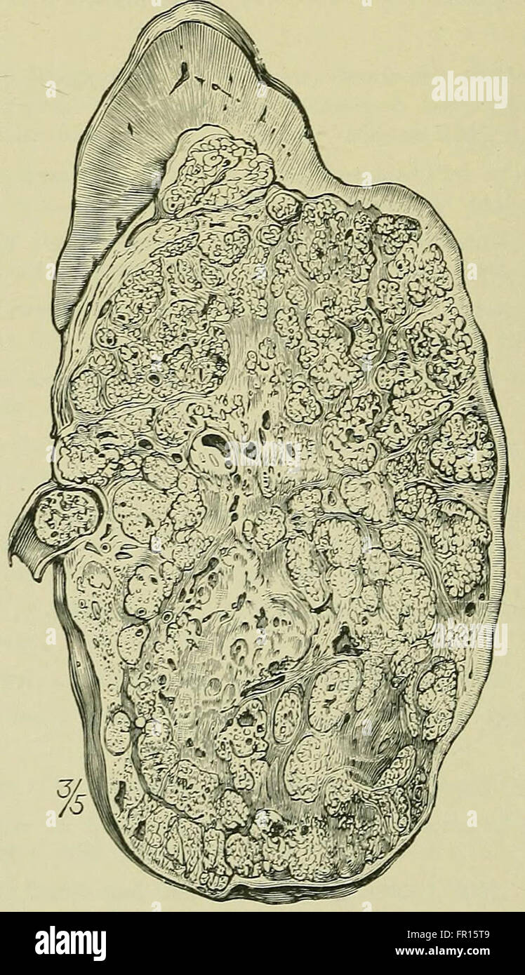 This work discusses the classification, clinical characteristics, and ...