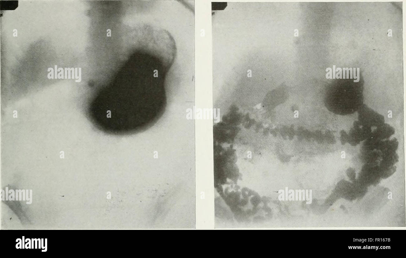 A 1906 journal focused on the advancements in roentgenology, radium ...