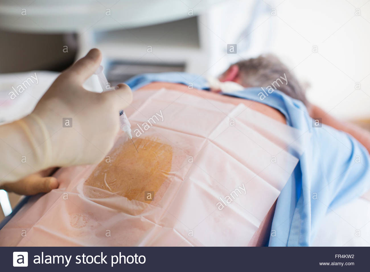 medical professional inserting needle into patients back Stock Photo ...