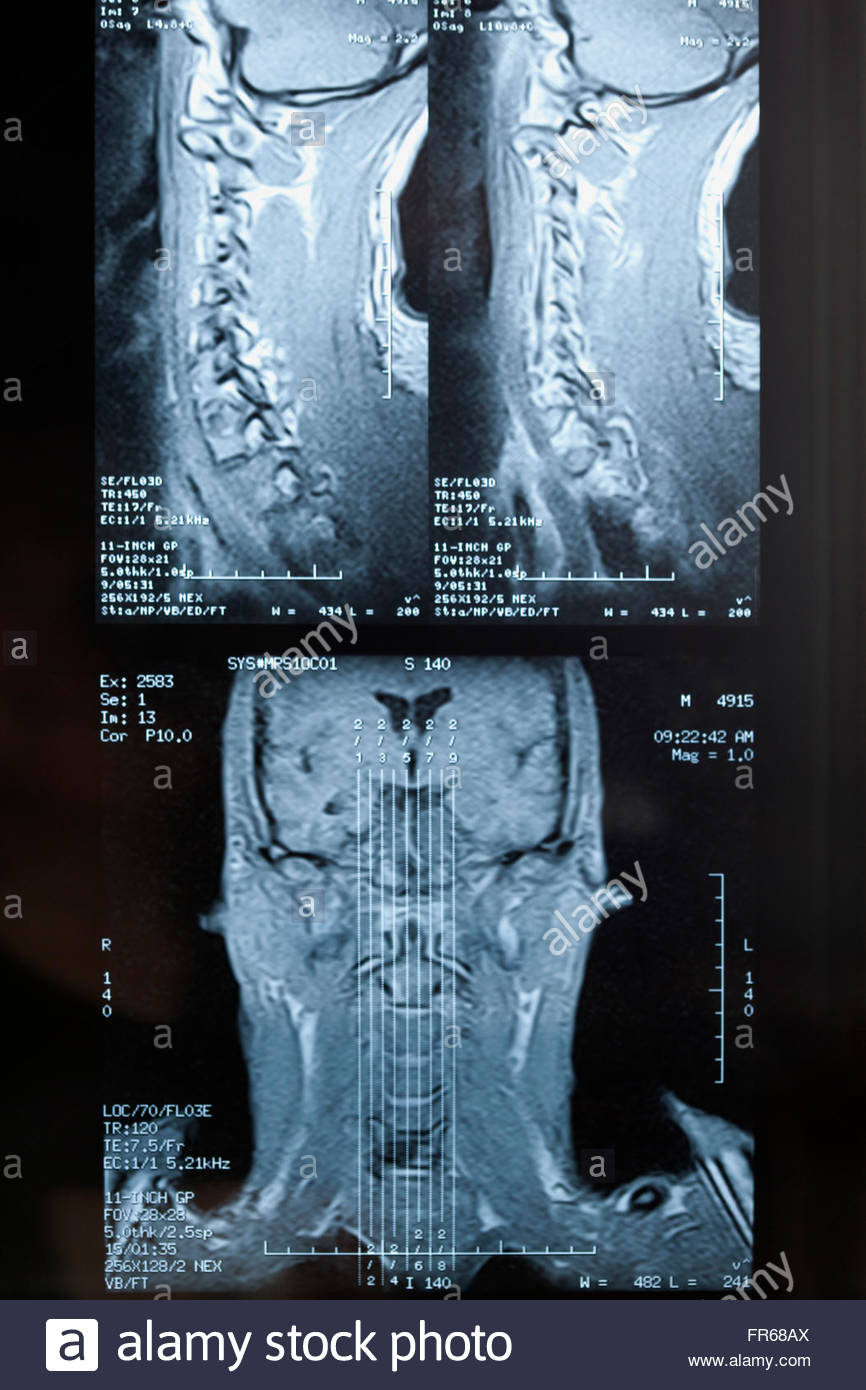 Human radiography hi-res stock photography and images - Alamy